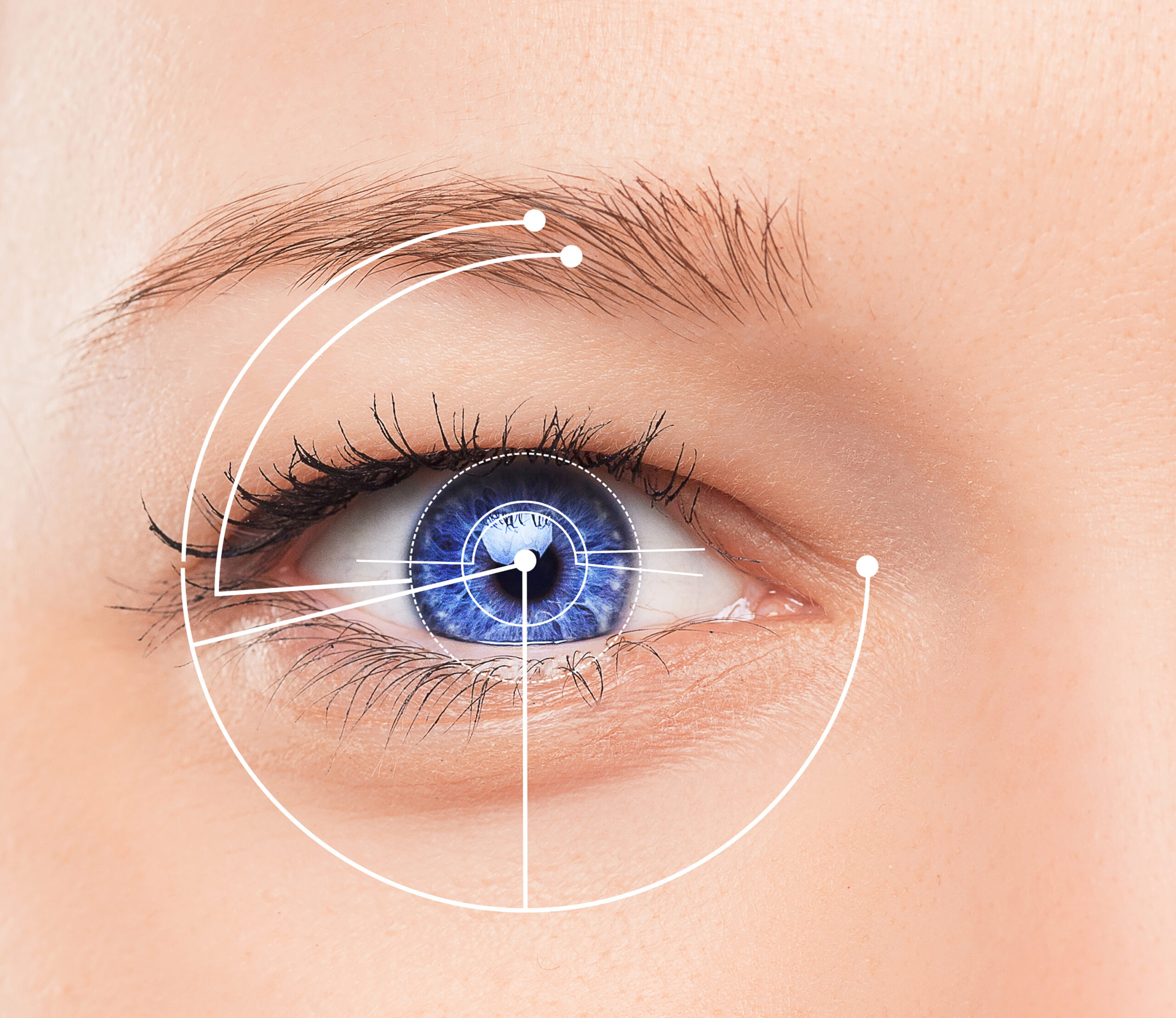 Best LASIK eye surgery in Delhi – Narang Eye Institute